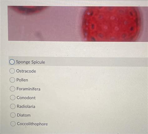 Solved Identify The Microfossil Pictured