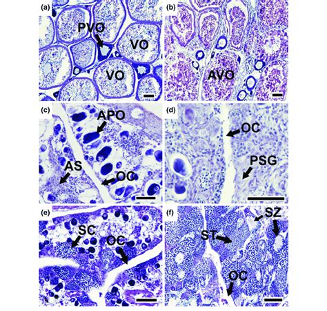 Process Of Gonadal Sex Change Induced By Female Pairs A Stage 1 Download Scientific Diagram