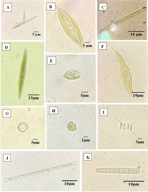 Organic Pollution Tolerant Algal Genera Found In The Sampling Locations Download Scientific