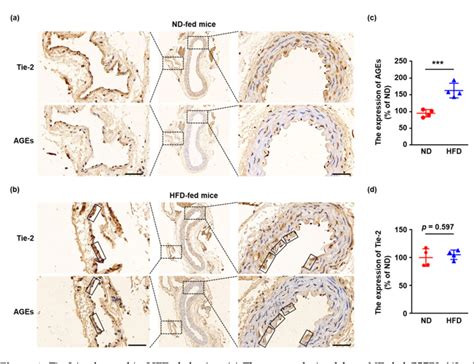 Pdf Glycation Of Tie 2 Inhibits Angiopoietin 1 Signaling Activation
