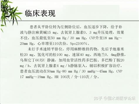 利血平与麻醉 PPT课件 知乎