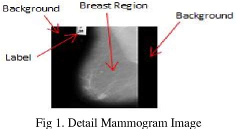 Figure 1 From Classification Of Breast Cancer Using Local Binary Pattern And Gabor Filter