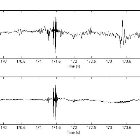 Pdf Hyolaryngeal Excursion As The Physiological Source Of Swallowing