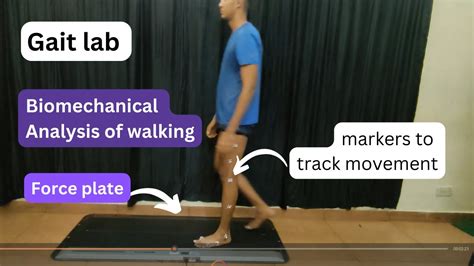 Visual Gait Lab At Daniel Gilmore Blog