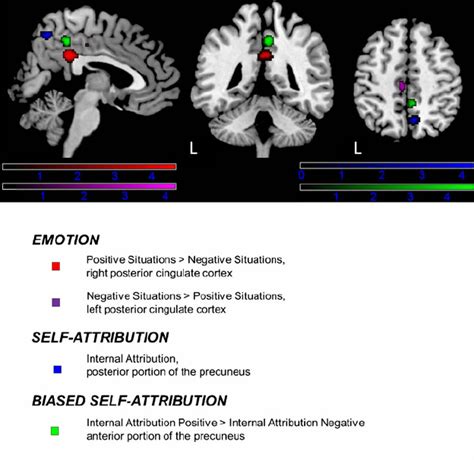 Schematic Depiction Of The Precuneus And The Posterior Cingulate Cortex Download Scientific