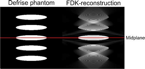 Illustration Of The High Cone Angle Artifact In A Defrise Phantom With