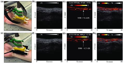 In Vivo Comparison Of Led Array Based And Laser Based Pa Vasculature Download Scientific