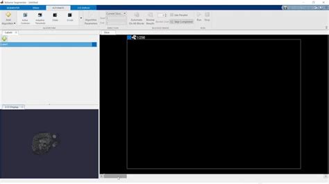 Hansen Cahyadi On Linkedin Imageprocessing Imagesegmentation Matlab