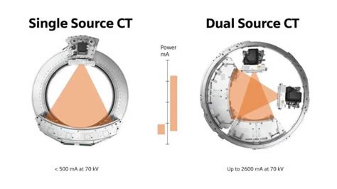 Mohammed H Alkhamisi On Linkedin Recent Advances In Cardiac Ct🫀☢️ Dual Source Scanners A Dual