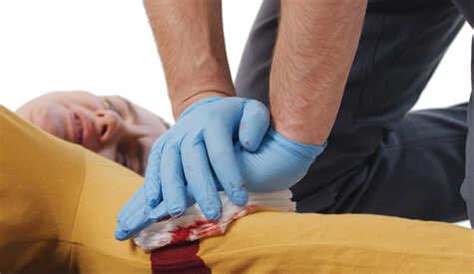 Stop Life Threatening Bleeding Fire Eagle First Aid Llc