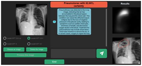 Using Segmentation To Boost Classification Performance And Explainability In Capsnets