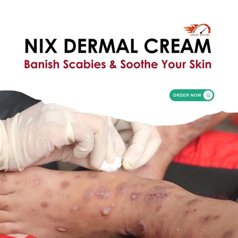 Buy Nix Dermal Cream 30g Permethrin 5 Pharmacy24®