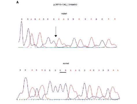 Automated Sequencing Tracing Data Revealing Mutations In Patients Download Scientific Diagram