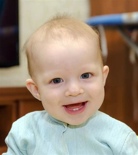 Epstein Pearls In Newborns 4 Essential Facts