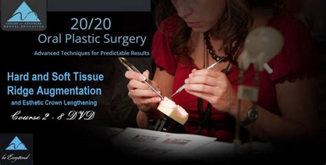 Hard And Soft Tissue Ridge Augmentation And Esthetic Crown Lengthening Online Dental Library