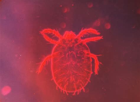 Chiggers In Shoes