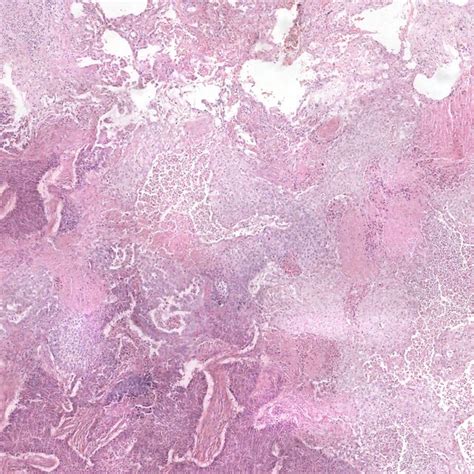 Fraction Of Label Appearance In The Segmentation Masks With 5 Classes Download Scientific