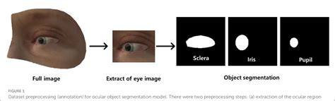 Figure 1 From Feasibility Of Video Based Real Time Nystagmus Tracking A Lightweight Deep