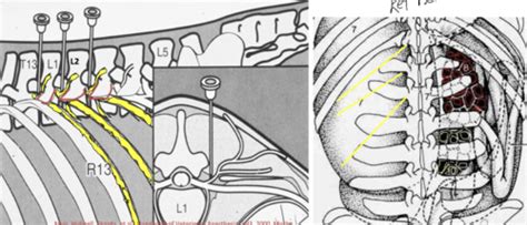 Clinical Anesthesia Nerve Blocks Flashcards Quizlet