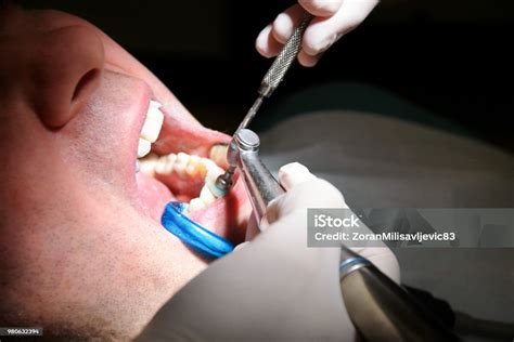 치과 치아 연마입니다 치아 청소 치과 위생입니다 그의 치과 진료소 및 사무실에서 직장에서 치과 도구 거울 부드러운 치과 브러시와 흡입 튜브 입에 환자 치아의 연마는 2명에