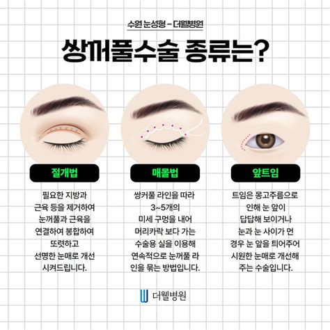수원 성형외과 눈성형과 주의사항 건강정보 수원 더웰병원