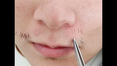 핀셋으로 콧수염 제모 Youtube