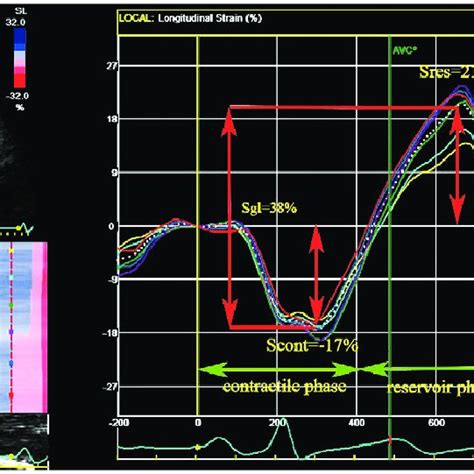 The Normal Graph Of La Longitudinal Deformation By P Wave Triggering Download Scientific