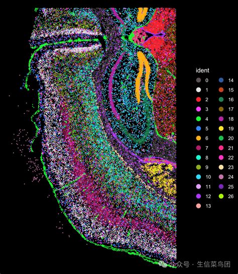 跟着seurat官网学xenium空转分析 · Issue 6156 · Ixxmumpduty · Github