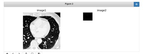 Resample To Same Spacing And Size And Align To Same Origin Beginner Questions Itk