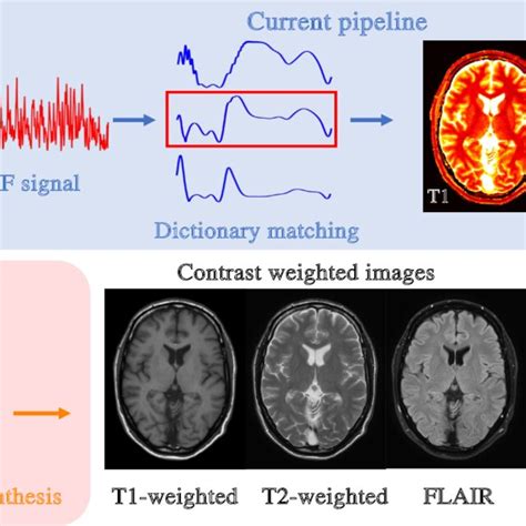contrast synthesis from mrf via current simulation based pipeline and