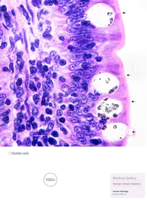 Goblet Cells Of The Human Small Intestine Stock Image Image Of Small