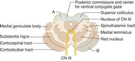 Spinothalamic Tract Midbrain