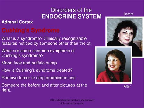 Ppt 4 04 Understand The Functions And Disorders Of The Endocrine
