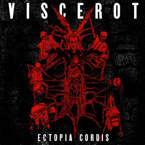 Ectopia Cordis Viscerot