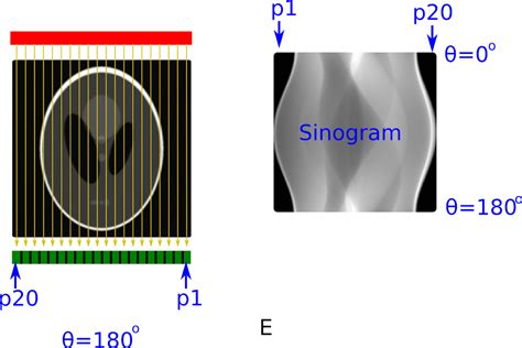 The Science Of Medical Imaging X Rays And Ct Scans