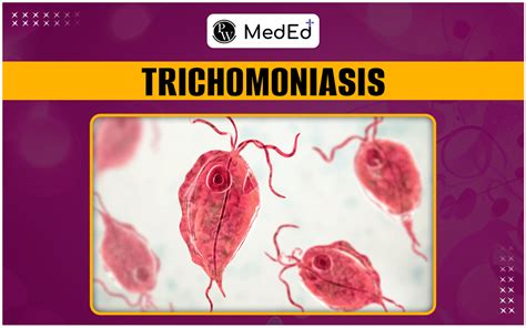 Trichomoniasis Causes Symptoms Risk Factors Prevention And Treatment
