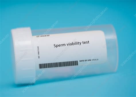 Sperm Viability Test Stock Image F042 0301 Science Photo Library