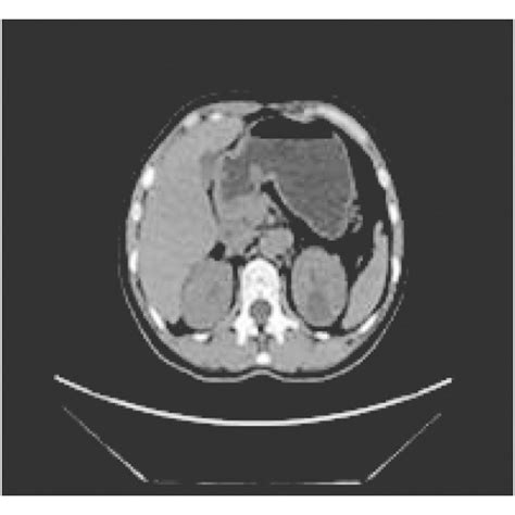 Flow Chart Of The Principle Of Iterative Reconstruction Algorithm