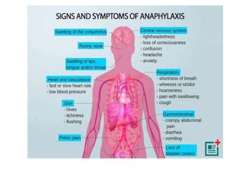 Final Anaphylactic Reactions And Anaphylactic Shock