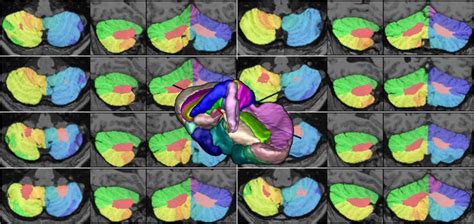 Cerebellum And Its Lobules Segmentation Nist