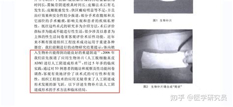 【文献解读】adm H阴道成形术可以同时实现解刨学与功能学双维度的有效 知乎