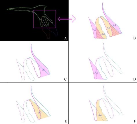 A Simple Diagram Describing Alveolar Modeling Remodeling When An