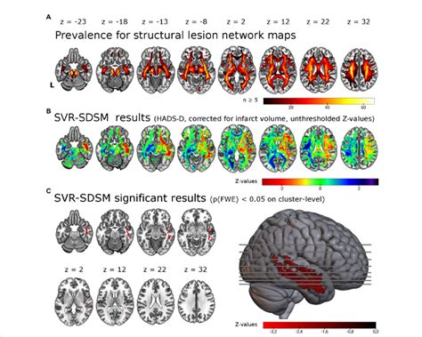 Support Vector Regression Structural Disconnection Mapping For Download Scientific Diagram