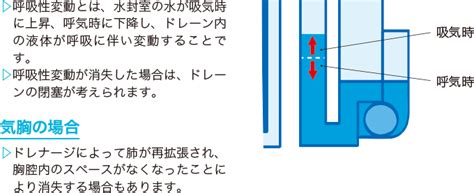 胸腔ドレナージ 看護roo [カンゴルー]