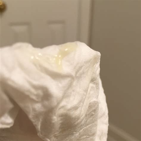 Does This Look Like Part Of My Plug Or Just Normal Discharge 39 Weeks Glow Community
