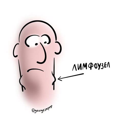 Воспалились лимфоузлы на шее Георгий Сапего врач иллюстратор