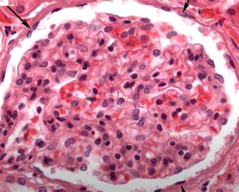 HAP Lab 6 Flashcards Quizlet HAP Lab 6 Flashcards Quizlet