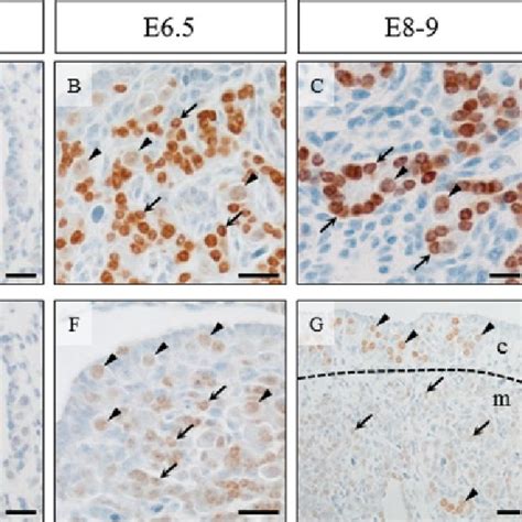 Doublesex And Mab 3 Related Transcription Factor 1 Dmrt1 Localization Download Scientific