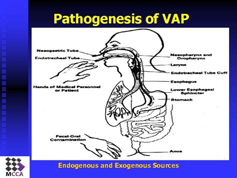 Hospital Acquired Pneumonia Hap Ventilator Associated Pneumonia Vap Thursday