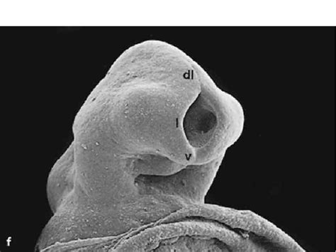 Transverse Sections Showing Development Of The Mesodermal Germ